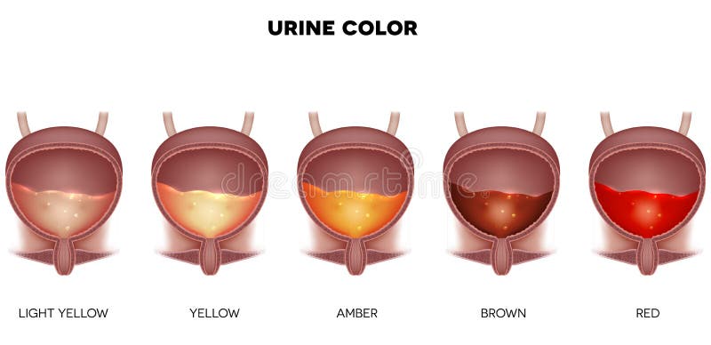 Gráfico De Cores Da Urina, Urina Em Tubos De Ensaio, Vetor Médico ...