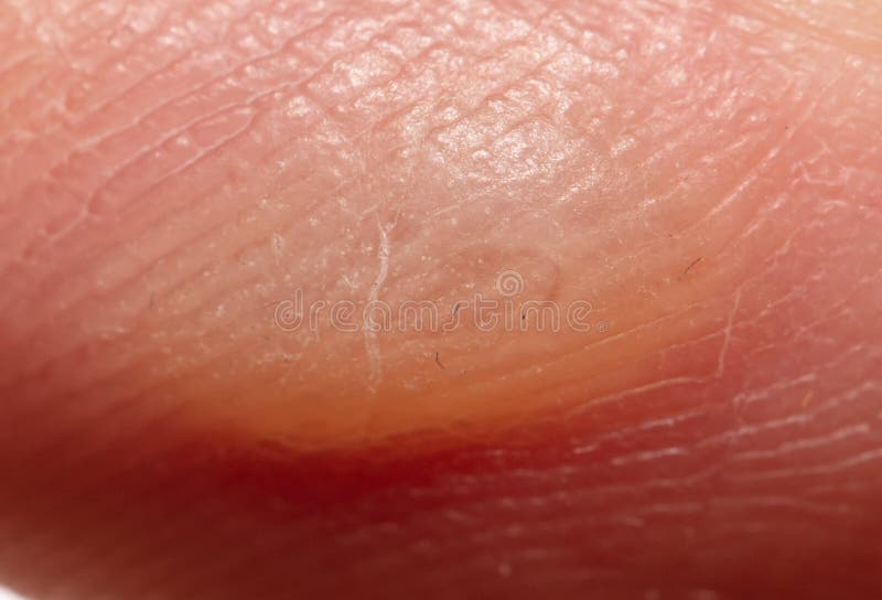 Corn on a Finger Isolated on a White B Stock Photo - Image of closeup ...