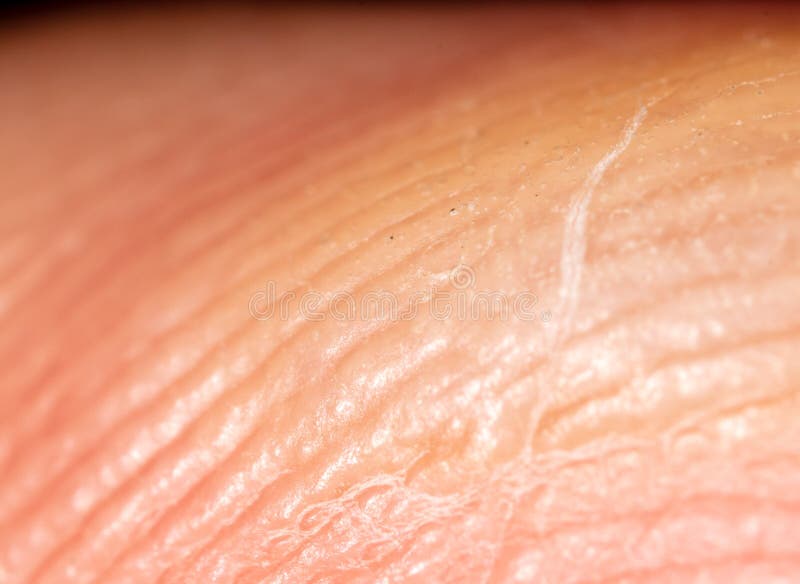 Corn on the Finger As a Background Stock Photo - Image of hand, wound ...