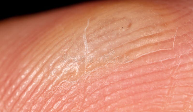 Corn on a Finger Isolated on a White B Stock Photo - Image of closeup ...