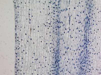 Corn root tip micrograph stock image. Image of micrograph - 48457873