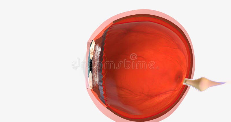The Cornea is the Transparent, Outer Dome Forming the Anterior (front ...