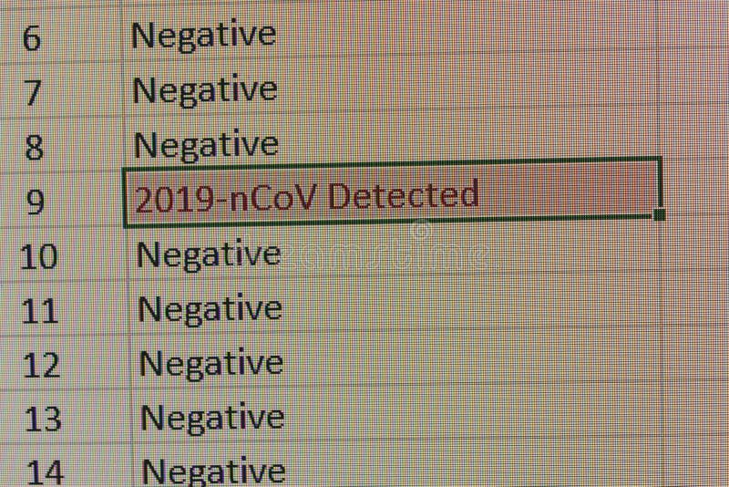 Corona Virus Detection Test Results Stock Photo - Image of pandemic ...
