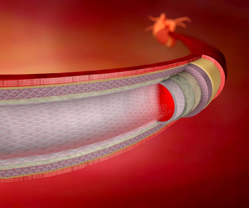 Coronary artery stock illustration. Illustration of medical - 35071250
