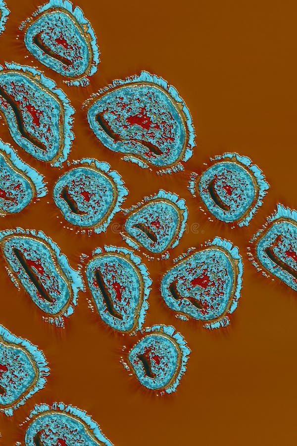 Human Virus, Flu, View of a Virus Under a Microscope, Viral Disease ...