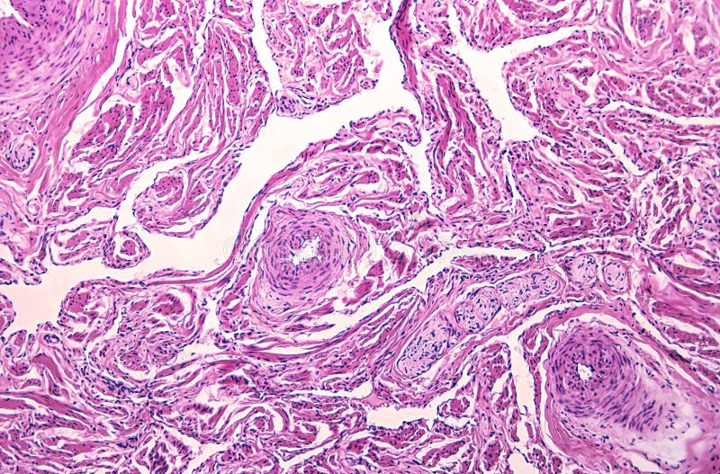 Genital Nerves Stock Photos - Free & Royalty-Free Stock Photos from ...