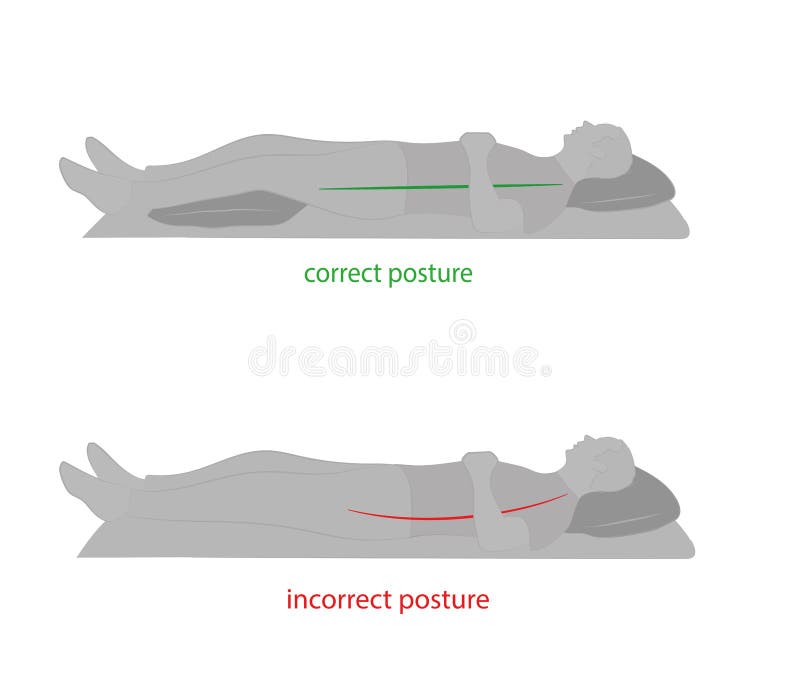 Correct And Incorrect Posture. Side And Rear View. Medical ...