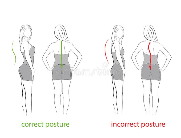Correct and Incorrect Posture. Side and Rear View. Medical ...