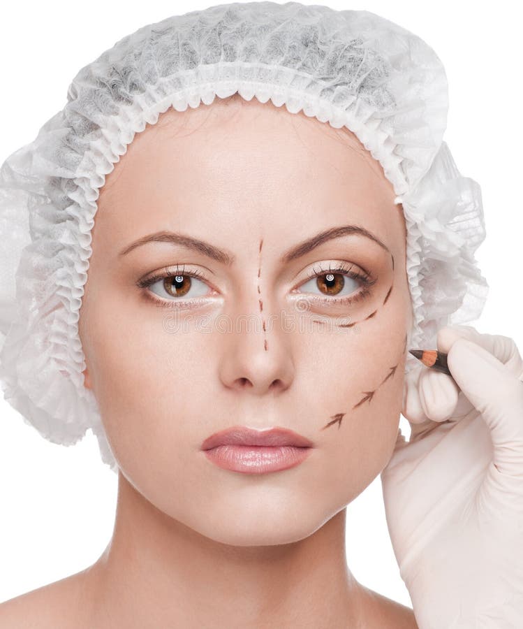 Correction Lines on Woman Face, before Surgery Stock Image - Image of ...