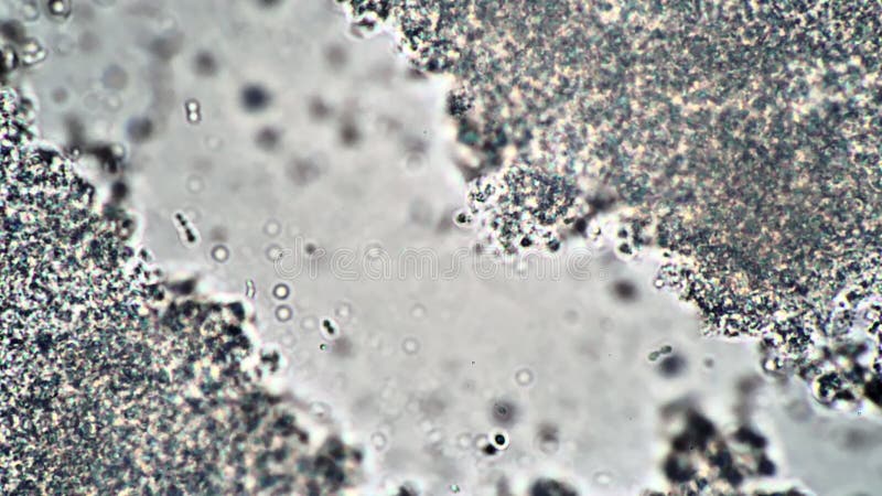 Lactic Acid Leaven from Sticks and Bacilli Under the Microscope Stock ...