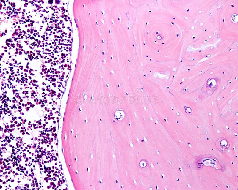 Cortical bone stock photo. Image of haversian, osteocyte - 220382950