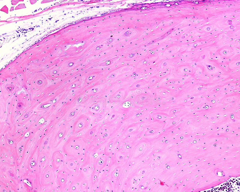 Cortical bone tissue stock image. Image of haversian - 220382895