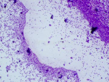 Coryneform Bacterium stock image. Image of biochemistry - 351328097