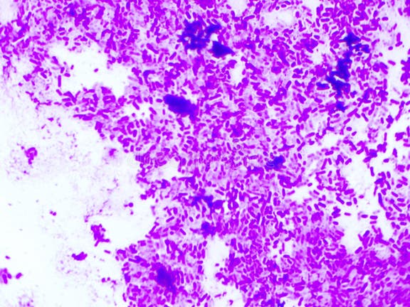 Coryneform Bacterium stock image. Image of coryneform - 351328699