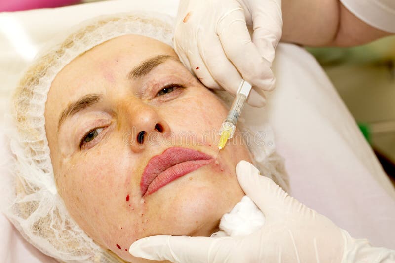 Cosmetic surgery stock photo. Image of medical, cosmetic - 34876948