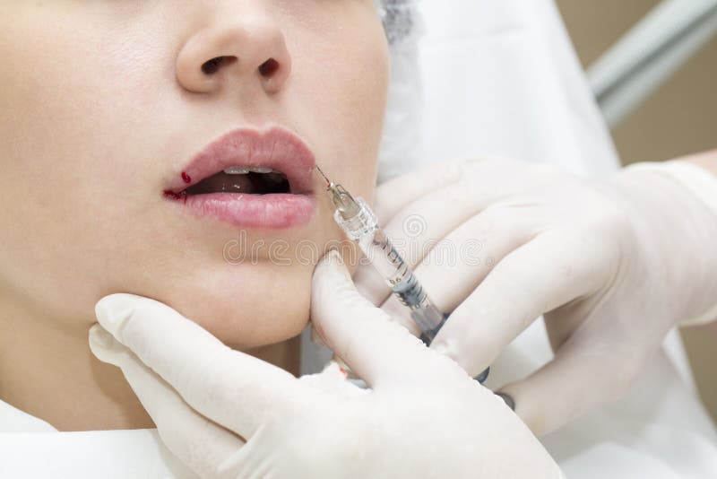 Cosmetic Treatment with Injection Stock Photo - Image of medical ...