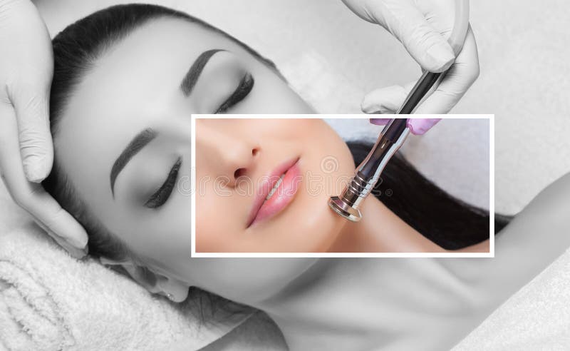 The Cosmetologist Makes The Procedure Microdermabrasion Of The Facial