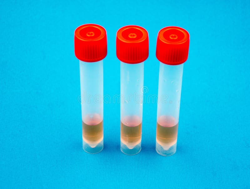 Cotonete e tubo Pharyngeal foto de stock. Imagem de cotonete - 39658722