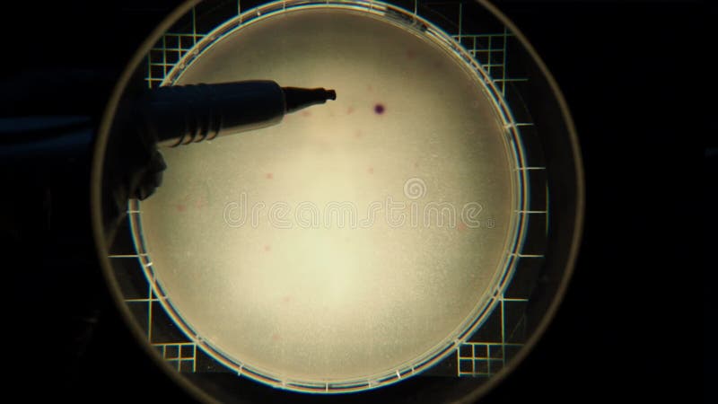 Colony Counting of Bacteria Stock Video - Video of medicine, culture ...
