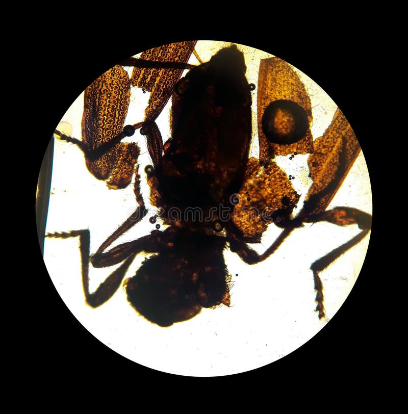 Coutil D'Ixodes, Vue Du Microscope Coutil Dans Le Laboratoire Photo ...