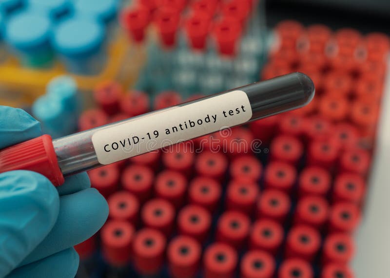 COVID-19 Antibody Test, Blood Sample Tube Stock Photo - Image of ...