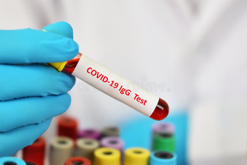 Blood Sample Tube for COVID-19 IgG Antibody Test Stock Photo - Image of ...
