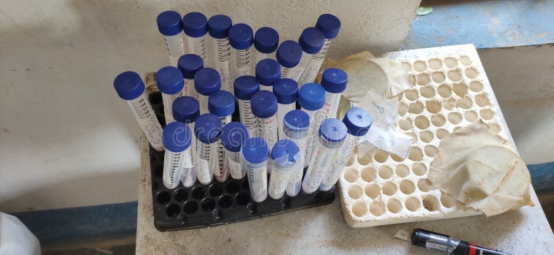 Covid19 Corona Testing Kit Kept for Testing Being Done. India Stock ...