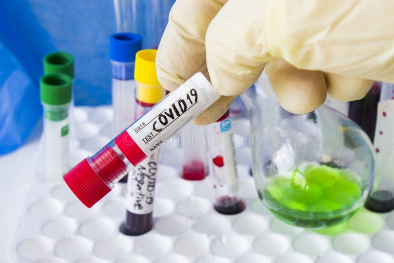 Covid - 19 and Corona Virus Blood Test, Negative and Positive Tests in ...