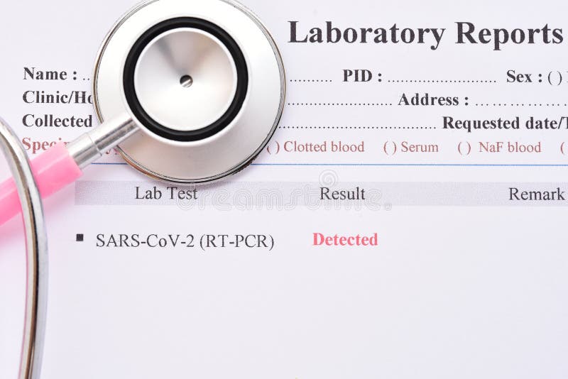 COVID-19 Detected Result by Using RT-PCR Method Stock Photo - Image of ...
