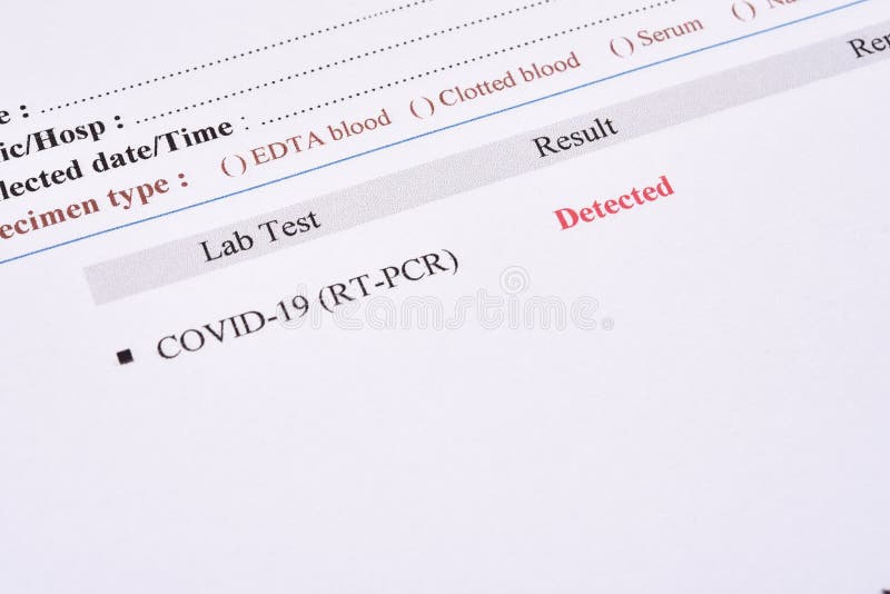 COVID-19 Detected Result by Using RT-PCR Method Stock Photo - Image of ...