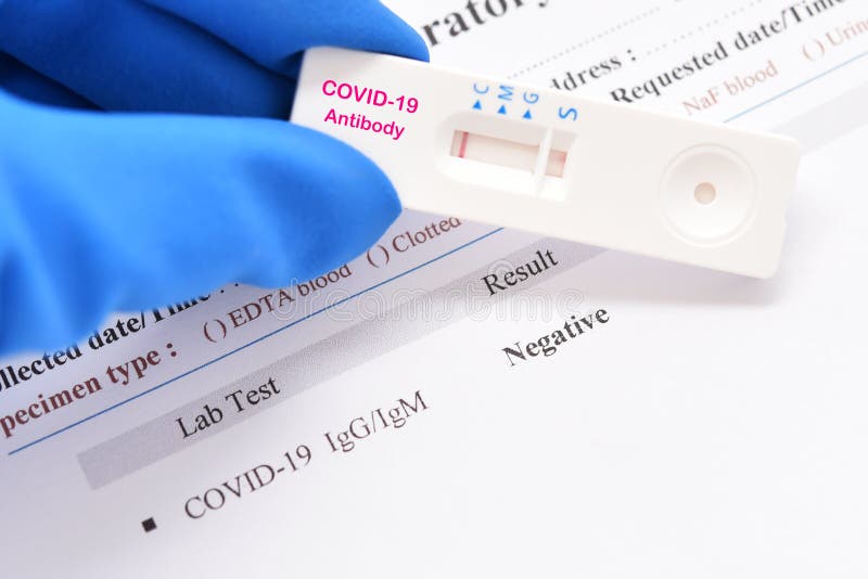 COVID-19 Negative and Positive Test Results Stock Photo - Image of ...