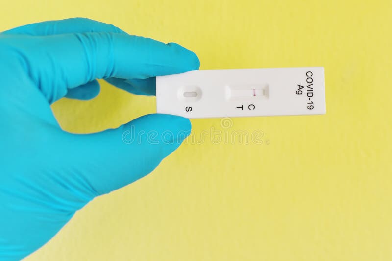 COVID-19 Negative and Positive Test Results Stock Photo - Image of ...