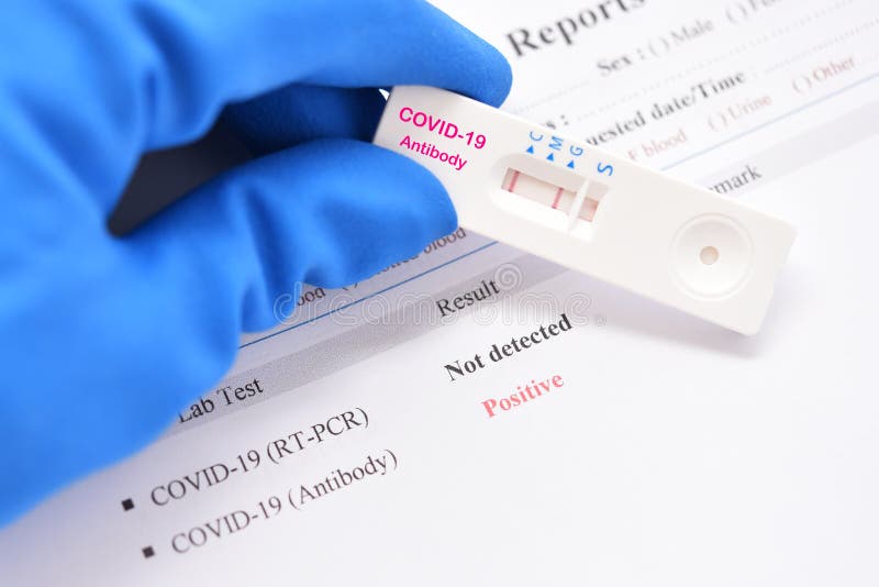 COVID-19 Negative Result by RT-PCR Method but Positive by Rapid Test ...