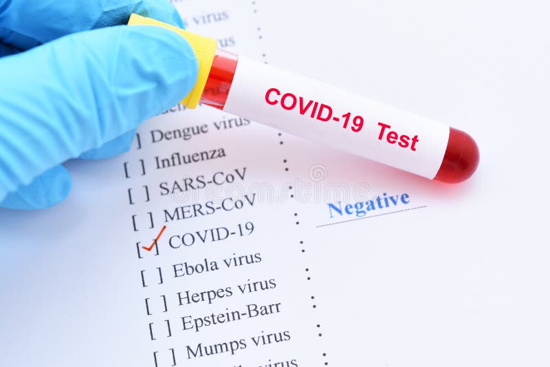 COVID-19 Negative Test Result Stock Image - Image of rtpcr, covid ...
