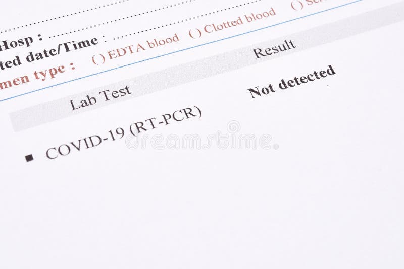 COVID-19 Not Detected Result by Using RT-PCR Method Stock Image - Image ...