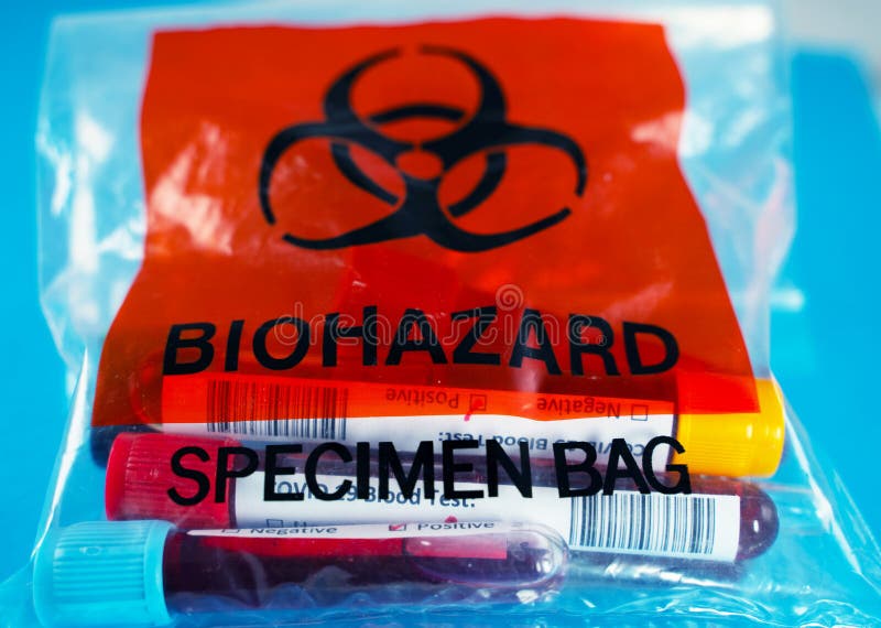 Covid Patients Blood Samples in a Medical Waste Bag Stock Photo - Image ...