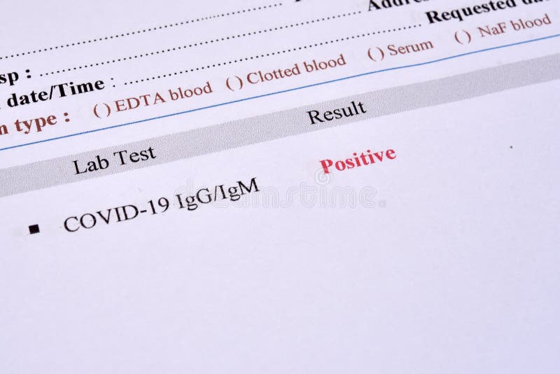COVID-19 positive result stock image. Image of disease - 173866911