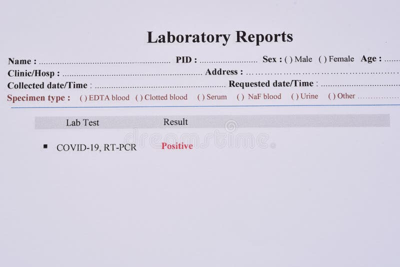 COVID-19 Positive Result by Using RT-PCR Method Stock Photo - Image of ...