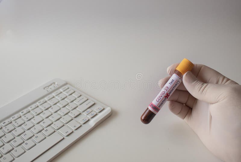 Covid19 positive test stock photo. Image of covid, assistant - 186290108