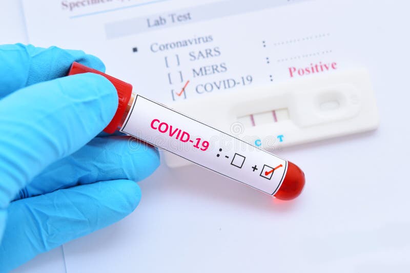 COVID-19 Positive Test Result by Rapid Card Test Stock Photo - Image of ...