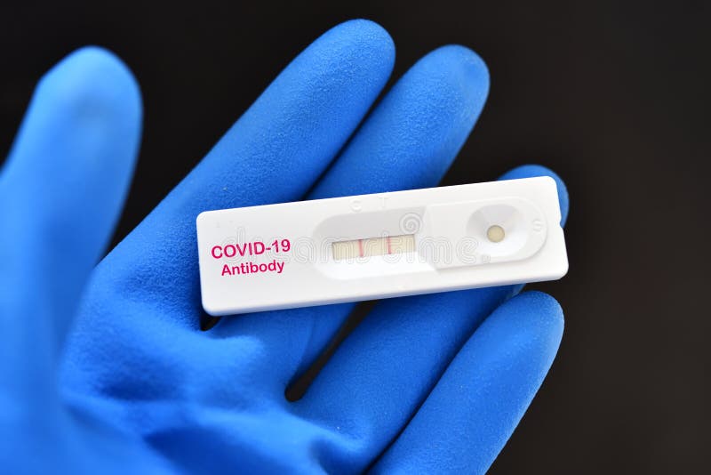 COVID-19 positive result stock image. Image of disease - 173866911