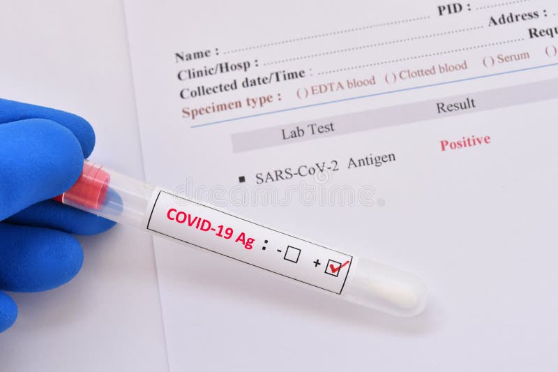 COVID-19 Negative and Positive Test Results Stock Photo - Image of ...
