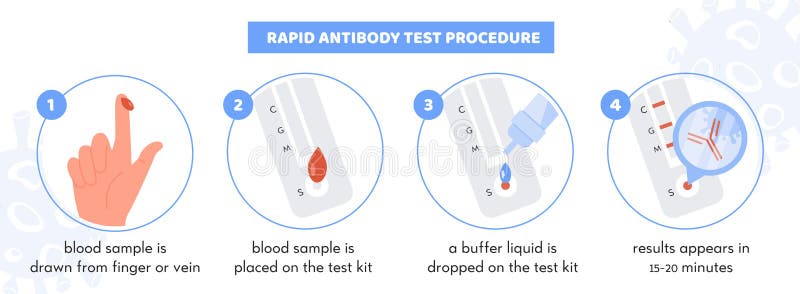 Covid-19 Rapid Antibody Test Procedure Infographic. Test Kit with ...