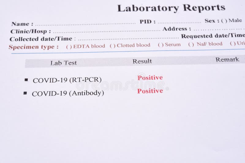 RSV positive test result stock image. Image of sars - 289758023