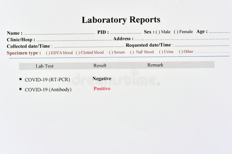 COVID-19 Negative and Positive Test Results Stock Image - Image of ...