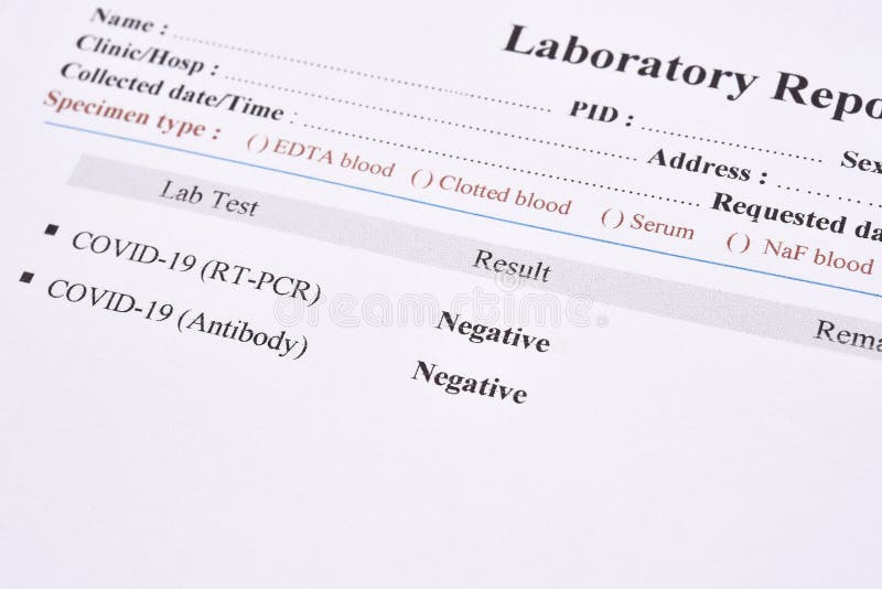 COVID-19 Negative Results by Using RT-PCR and Rapid Test Antibody ...