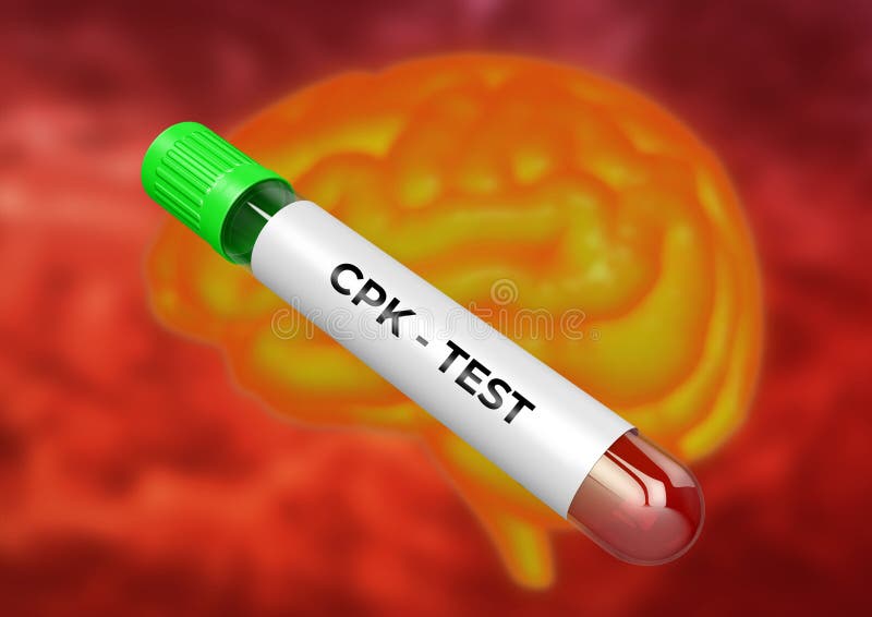 CPK Creatine Phosphokinase is an Enzyme Present in Muscles, Brain ...