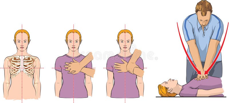 CPR demonstration stock vector. Illustration of doctor - 47130723