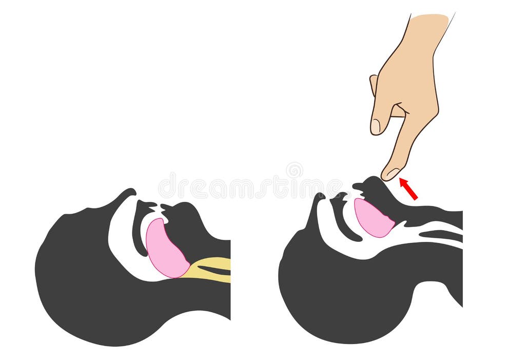 Airway Breathing Stock Illustrations – 599 Airway Breathing Stock ...