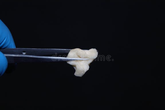 Crack stock image. Image of addiction, death, rock, crack - 8493935